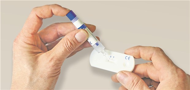 iFOBT hilft bei Abklärung von unspezifischen Symptomen