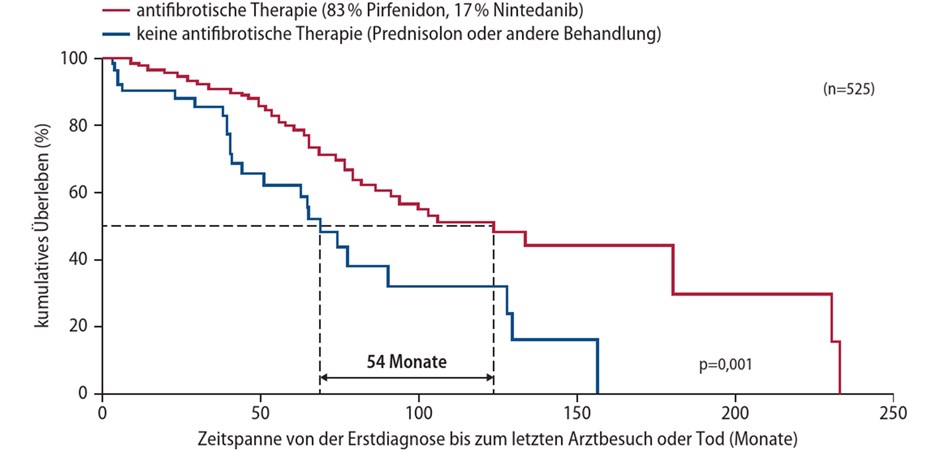 Progression der idiopathischen Lungenfibrose verlangsamen