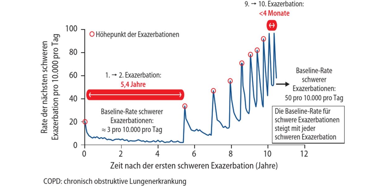 Dupilumab als erstes Biologikum zur COPD-Therapie zugelassen