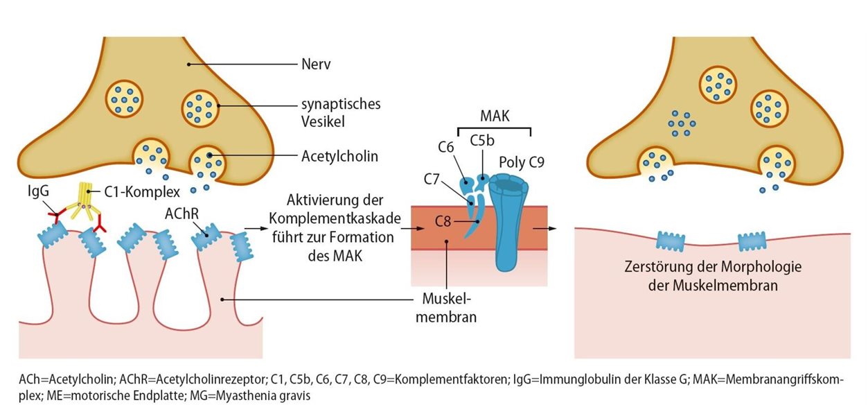 Welche Bedeutung hat das Komplementsystem?