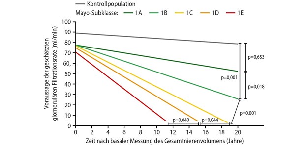 Tolvaptan bei ADPKD – Studiendaten, geeignete Patienten, Alltagserfahrungen