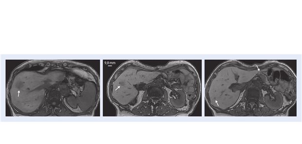 Vorhandene Therapieoptionen für eine optimale Sequenztherapie nutzen