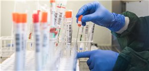 RKI ändert Testkriterien für SARS-CoV-2