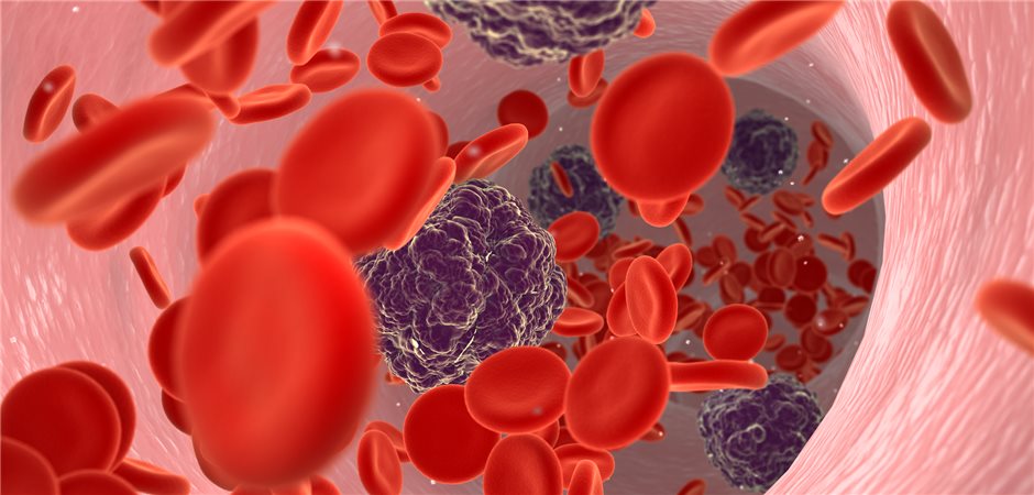 Kombitherapie gegen Leukämie – Probanden für Studie gesucht