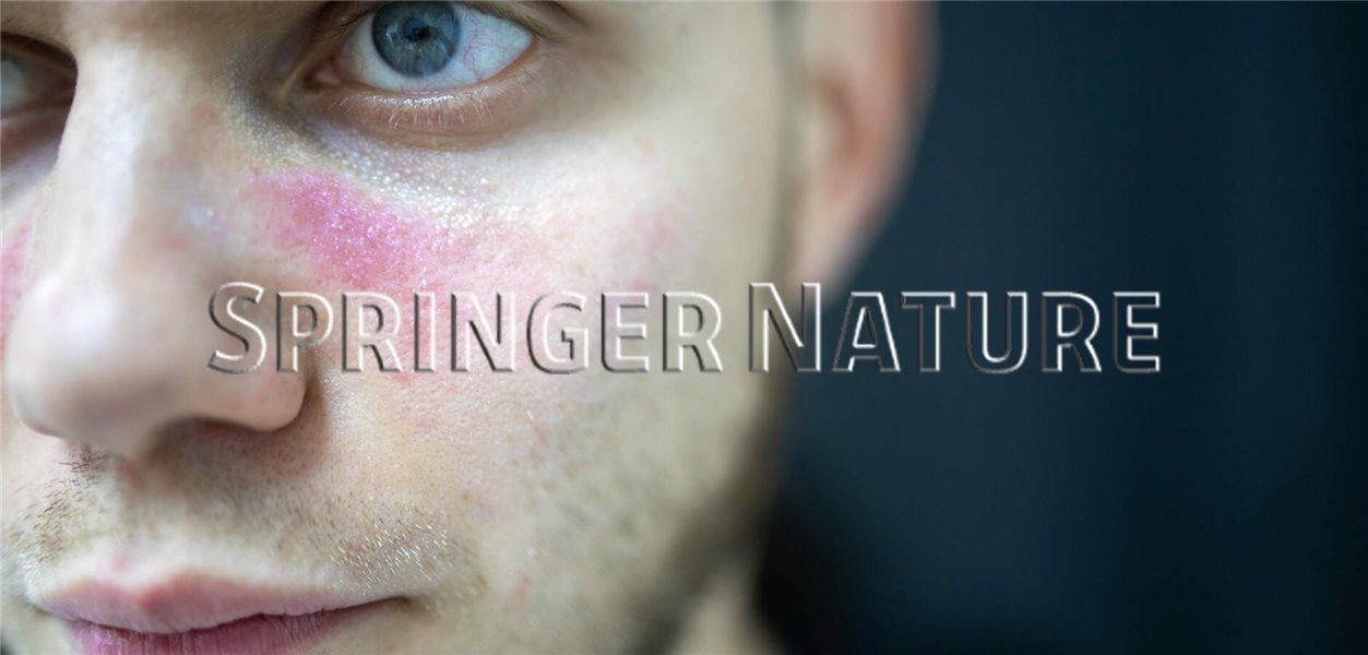 Mögliche genetische Ursache von systemischem Lupus identifiziert