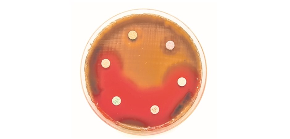 Resistenzraten gegen Antibiotika bleiben hoch