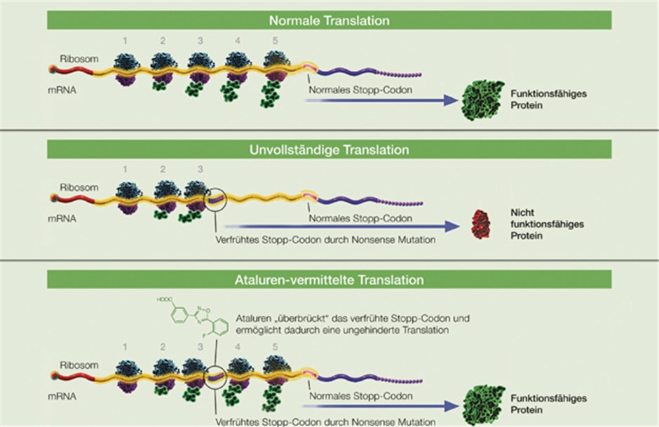 Translarna™ - erste kausale Therapie bei Duchenne-Muskeldystrophie