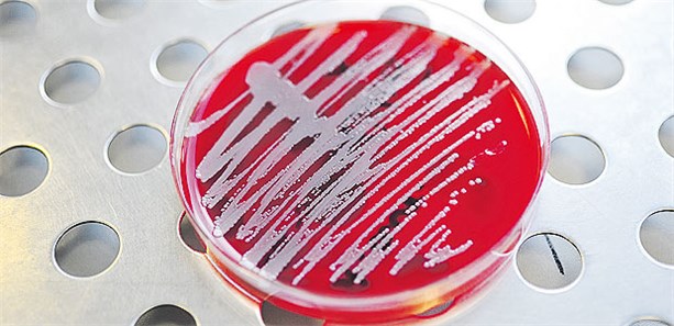 Resistente Erreger auf dem Vormarsch
