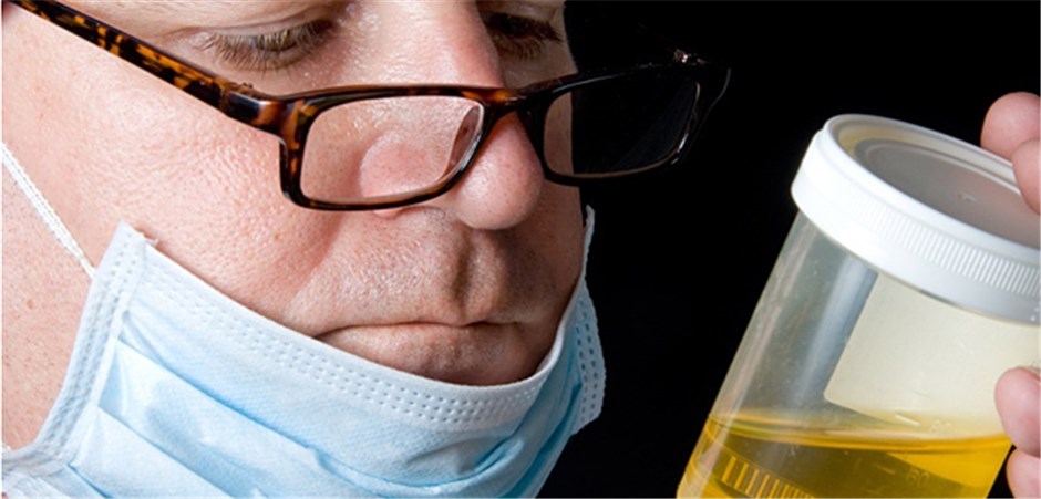 Proteinurie – Empfehlung für Stix