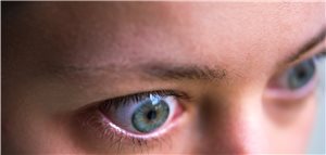 Endokrine Orbitopathie: Antikörper mindert Proptose deutlich