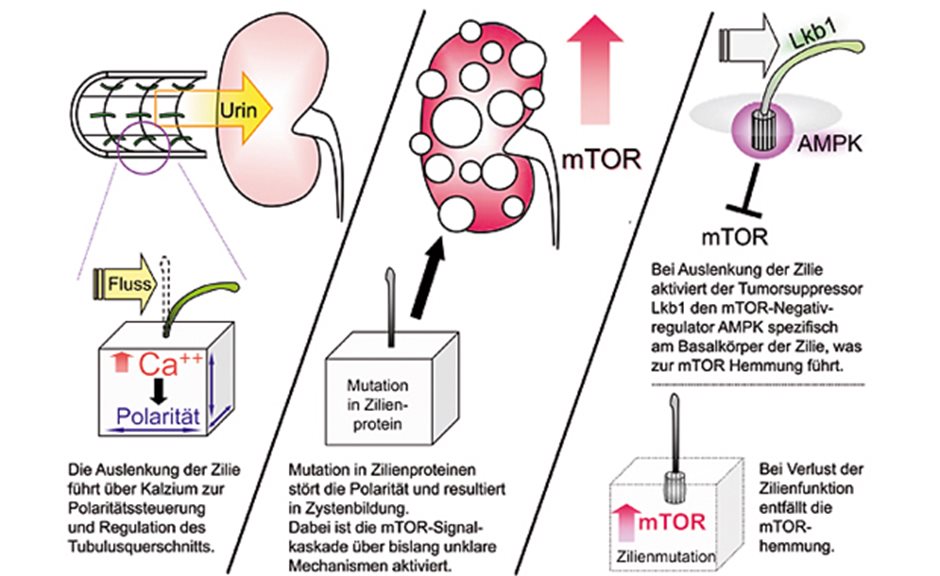 Nierenerkrankung: Von der Zilie bis zur Zyste
