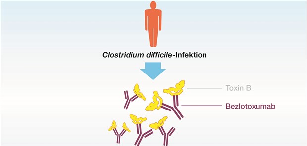 Zinplava® reduziert das Rekurrenzrisiko einer C. difficile-Infektion