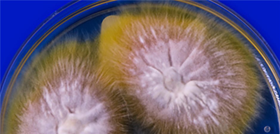 Dermatophytosen: Tipps für die Diagnostik und Behandlung