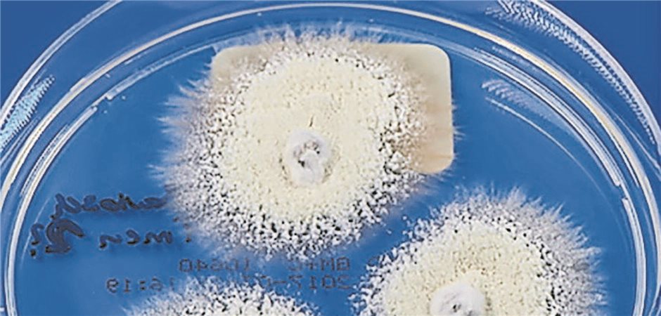 Dermatophytosen: Tipps für die Diagnostik und Behandlung