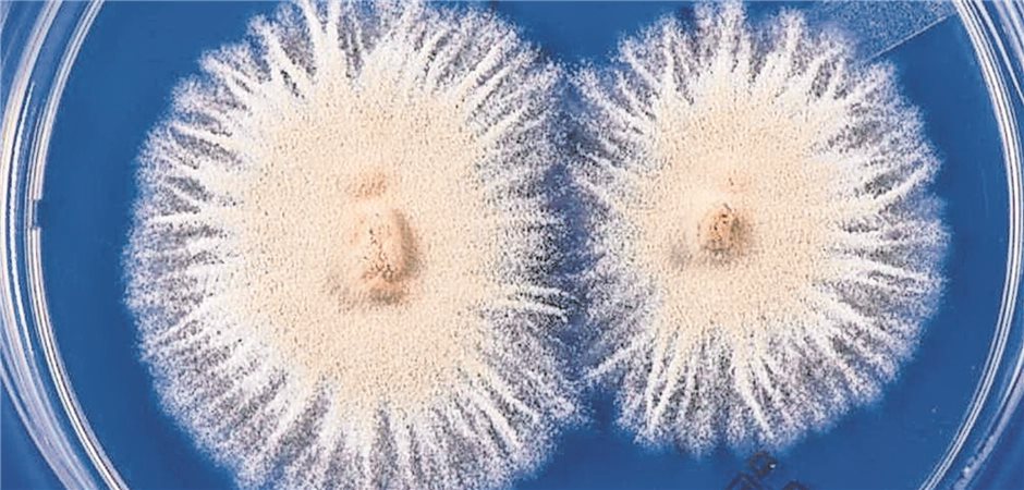 Dermatophytosen: Tipps für die Diagnostik und Behandlung