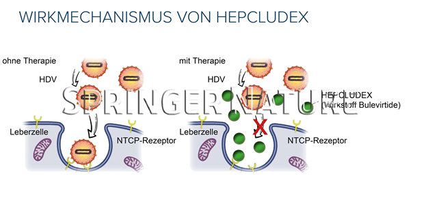 Hepcludex®: Erste Arznei gegen Hepatitis D in der EU zugelassen