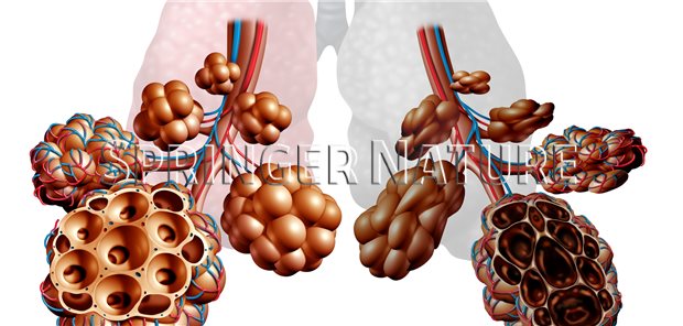 Auf dem Weg zur besseren COPD-Prognose