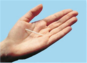 Langzeitkontrazeption bis zu fünf Jahre