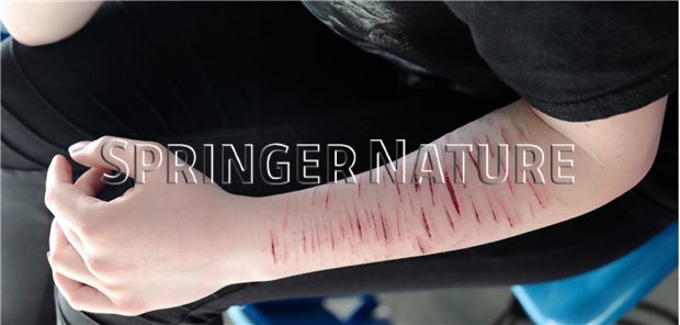 Schlafintervention mit weniger Selbstverletzungen bei Jugendlichen ...