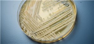 Candida auris: Der richtige Umgang mit einem expansiven Hefepilz