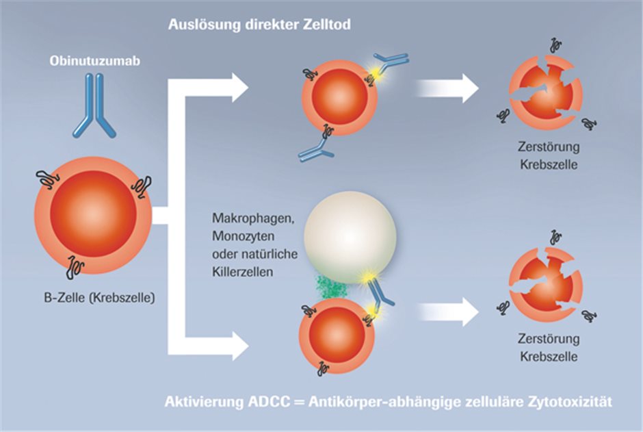 Gazyvaro® - überlegene Option für CLL-Patienten mit Begleiterkrankungen