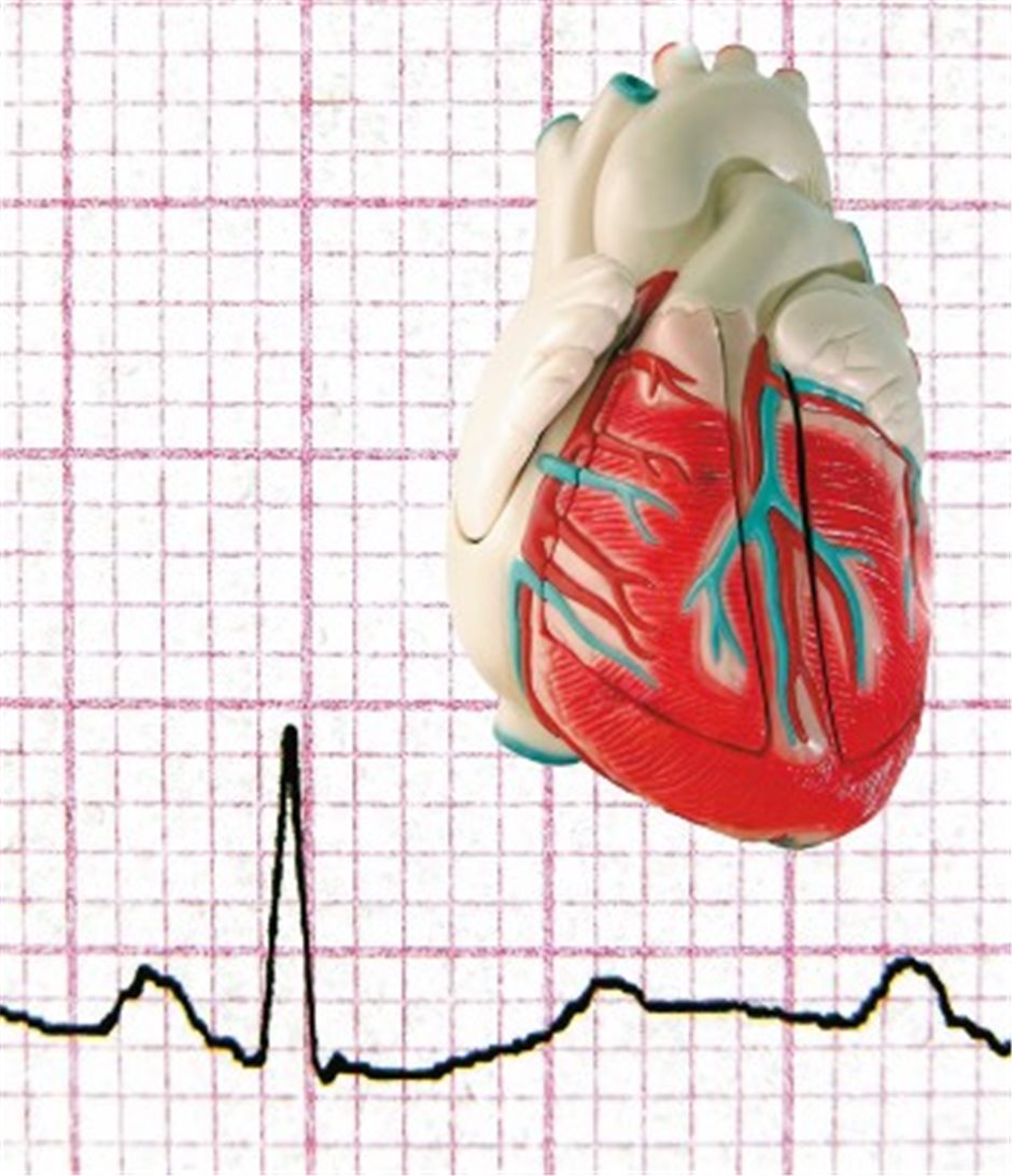Antiarrhythmikum Dronedaron jetzt in Deutschland verfügbar