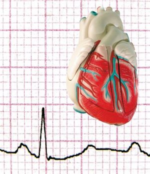 Antiarrhythmikum Dronedaron jetzt in Deutschland verfügbar