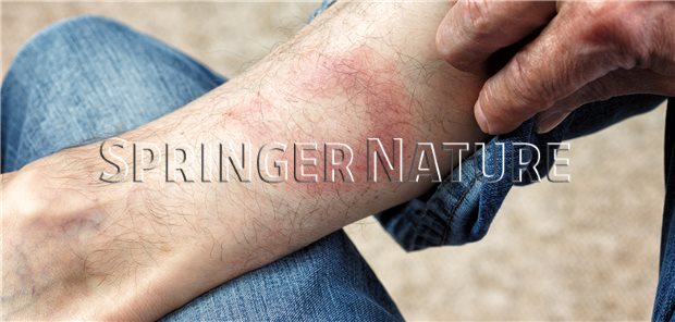 Drei Prozent mit Zeichen früherer Borreliose-Infektion