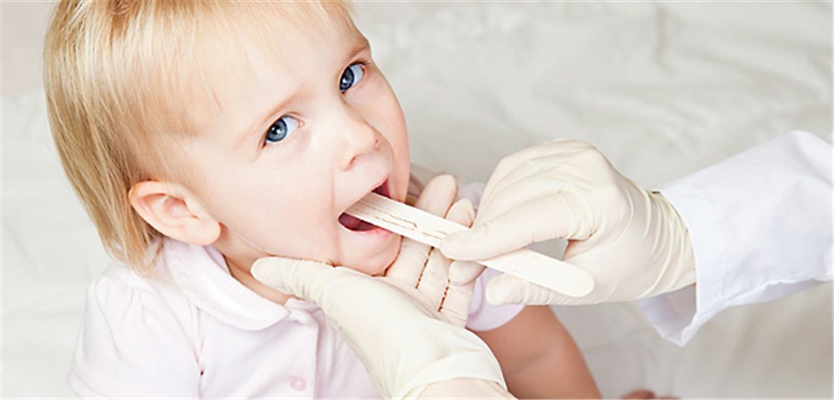 Wann eine Mandel-Op angebracht ist