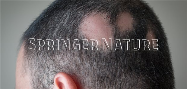 Monogener oder genetisch komplexer Haarausfall?