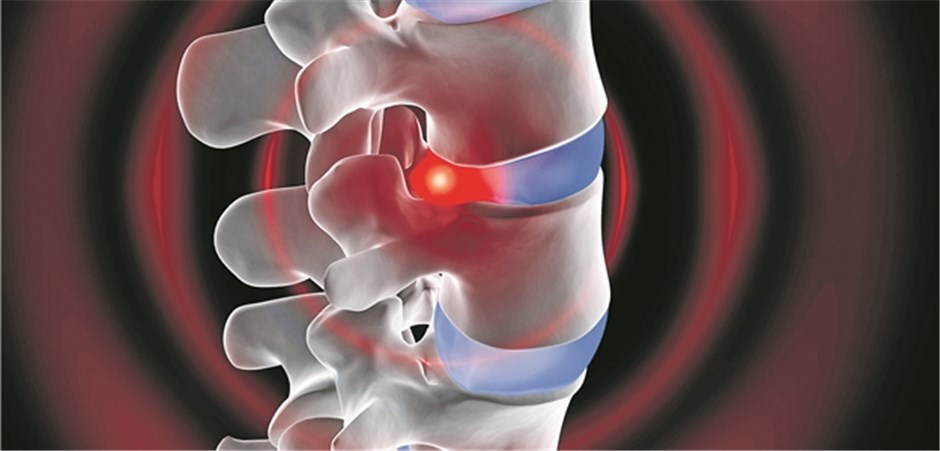 Magnetstäbe erlösten Patientin von Qualen bei Hohlkreuz