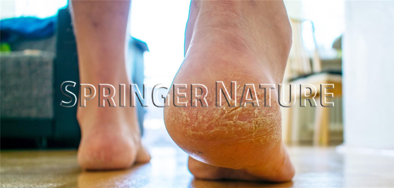 Tipps zu Rhagaden: Das Kreuz mit den Rissen in der Haut