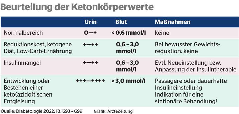 Wie sich ein Verdacht auf Ketoazidose schnell abklären lässt