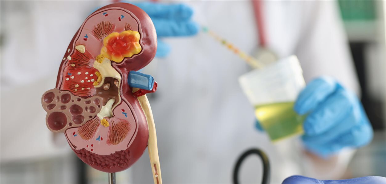 Unsichtbares Blut im Kinder-Urin: Alport-Syndrom könnte dahinterstecken