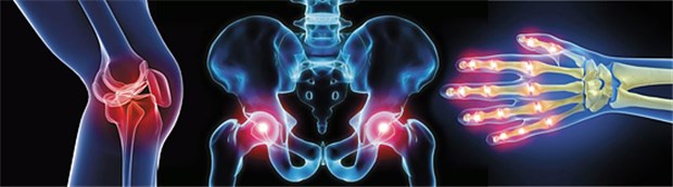 Rheumatologie 2010: große Fortschritte, aber anhaltende Versorgungsdefizite