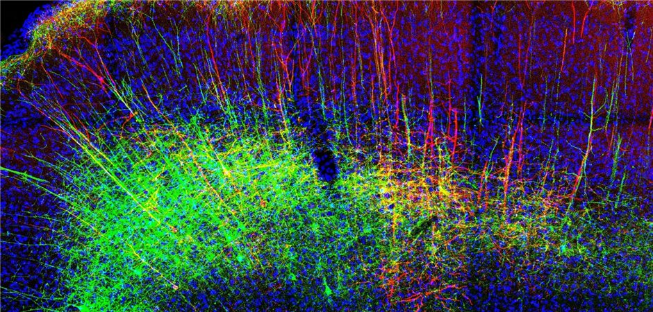 Gezielte Stimulation des Motorkortex lindert chronische Schmerzen