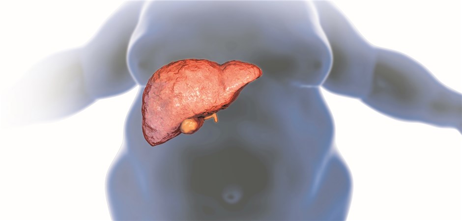 Fettleber – Alles andere als harmlos