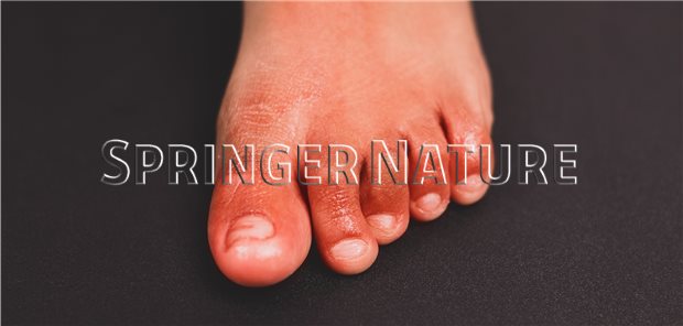 Das steckt hinter den Frostbeulen bei COVID-19-Patienten