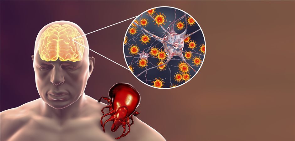 Deutlicher Anstieg von FSME-Fällen in der Schweiz