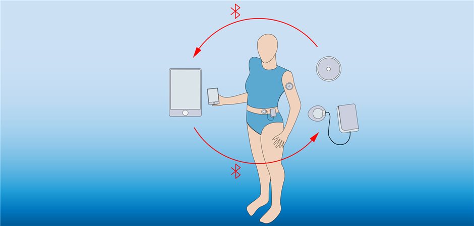 Typ 1 Diabetes Auch Senioren Profitieren Von Closed Loop Systemen typ-1-diabetes-auch-senioren-profitieren-von-closed-loop-systemen