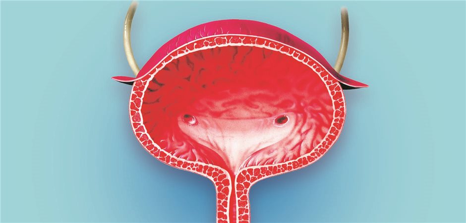 Zystitis: Mythen, Risiken, neue Empfehlungen
