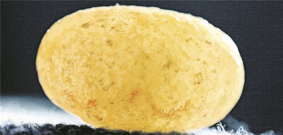 Harnstein – Welche Metaphylaxe bei wem?