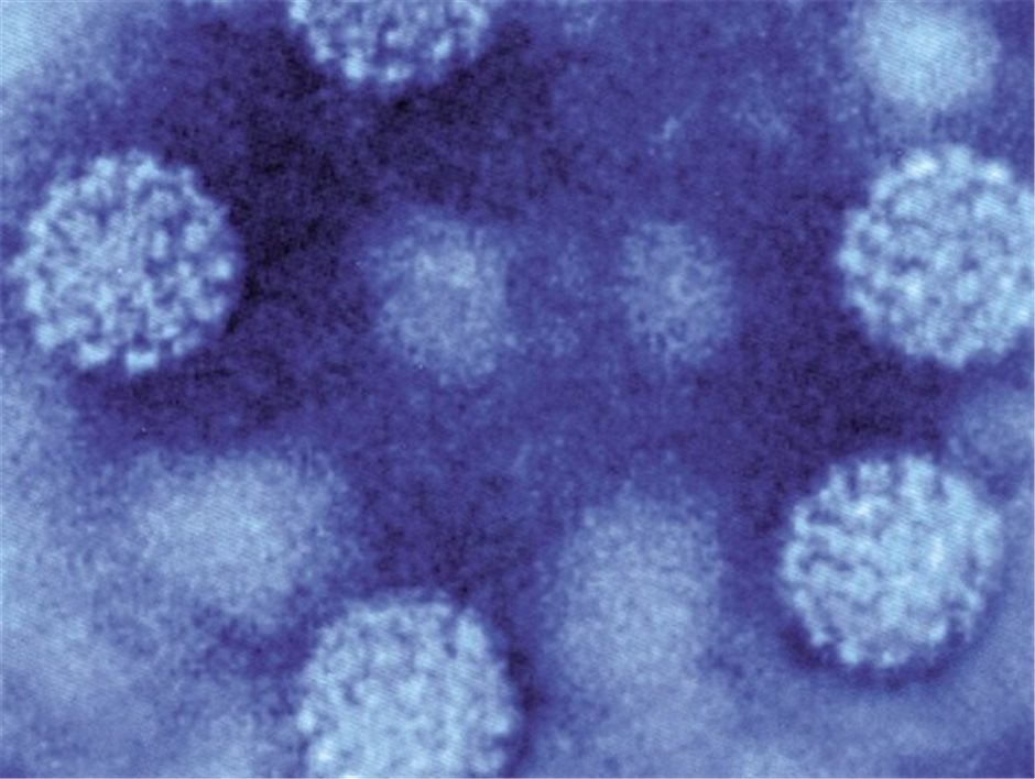 Pap-Abstrich plus HPV-Test - das verbessert die Früherkennung