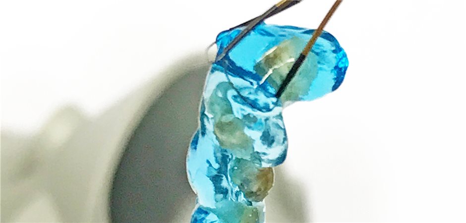 Nierensteintrümmer via Endoskop entfernen – mit Hydro-Gel