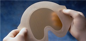 Hydrokolloid heilt Wunden am schnellsten