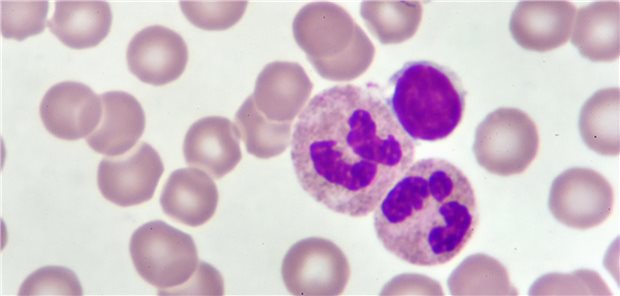 CLL und SLL: Pirtobrutinib bei stark vorbehandelten Patienten wirksam CLL und SLL: Pirtobrutinib bei stark vorbehandelten Patienten wirksam