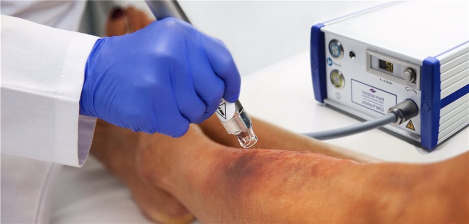 GBA setzt bei Wunden Kaltplasma an