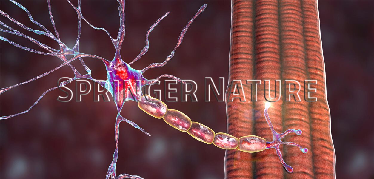 Erfolg mit CAR-T-Zell-Therapie bei refraktärer Myasthenia gravis