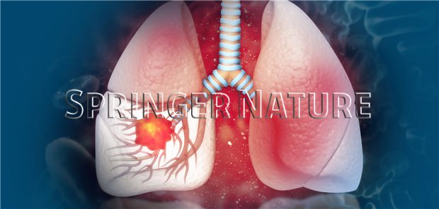 Radiatio bei Bronchialkarzinomen weiterentwickelt