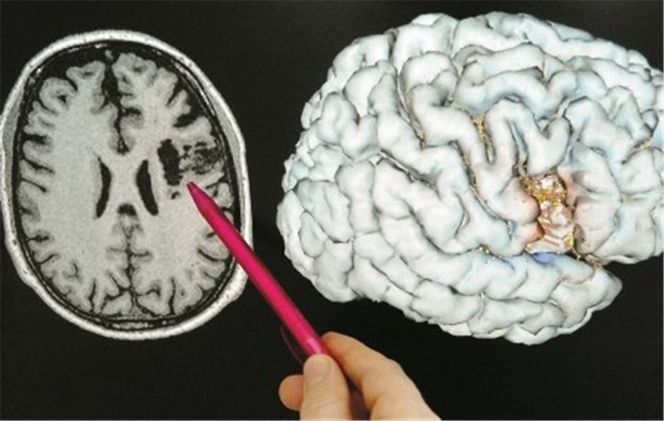 Kombi punktet bei Prävention nach Apoplexie